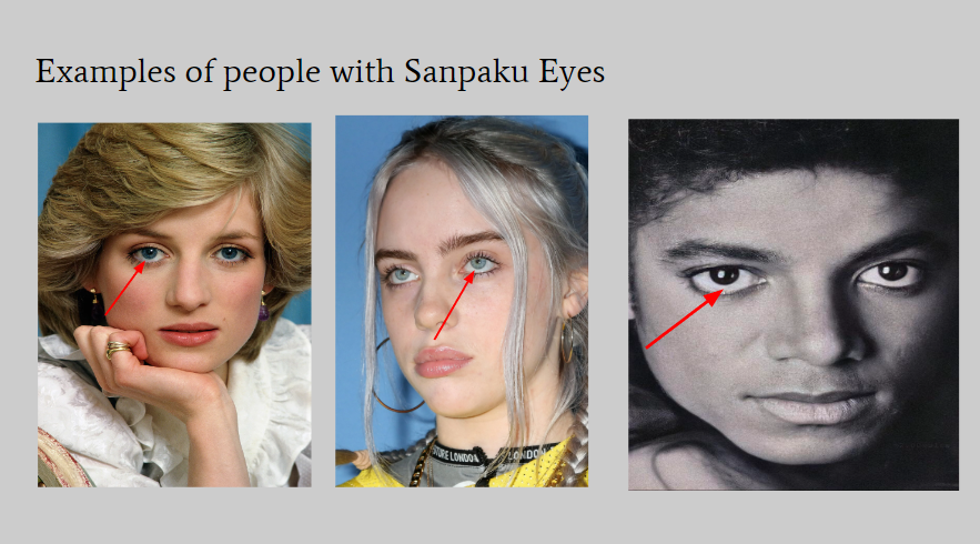 Sanpaku Eyes Presentation – sisterlucytruth.com